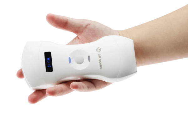 Portable & Wireless Ultrasound Scanner | DR.SONO®