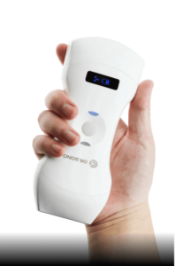 Portable & Wireless Ultrasound Scanner | DR.SONO®