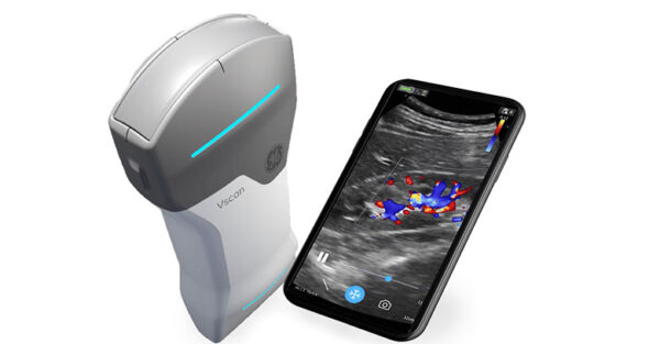 12 Affordable Portable & Handheld Ultrasound Machines | Complete Price ...