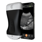 Portable & Wireless Ultrasound Scanner | DR.SONO®