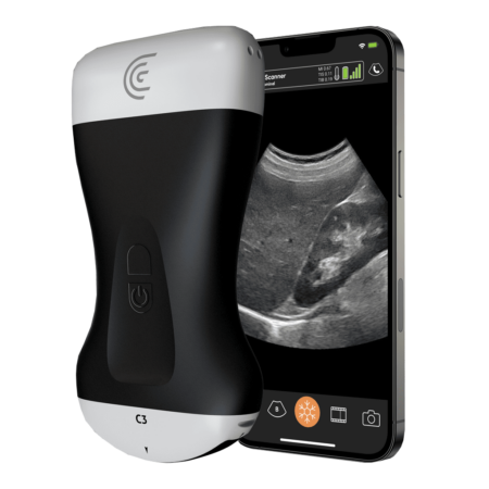Portable & Handheld Convex Ultrasound Scanner | DR.SONO®