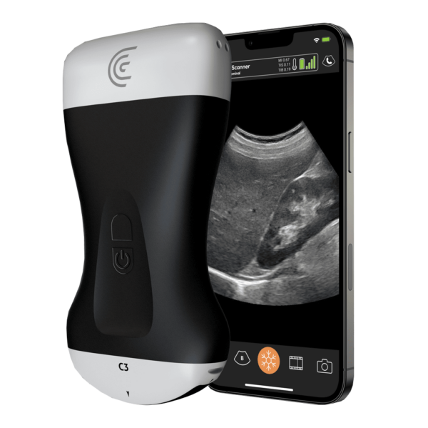 Portable & Wireless Ultrasound Scanner | DR.SONO®