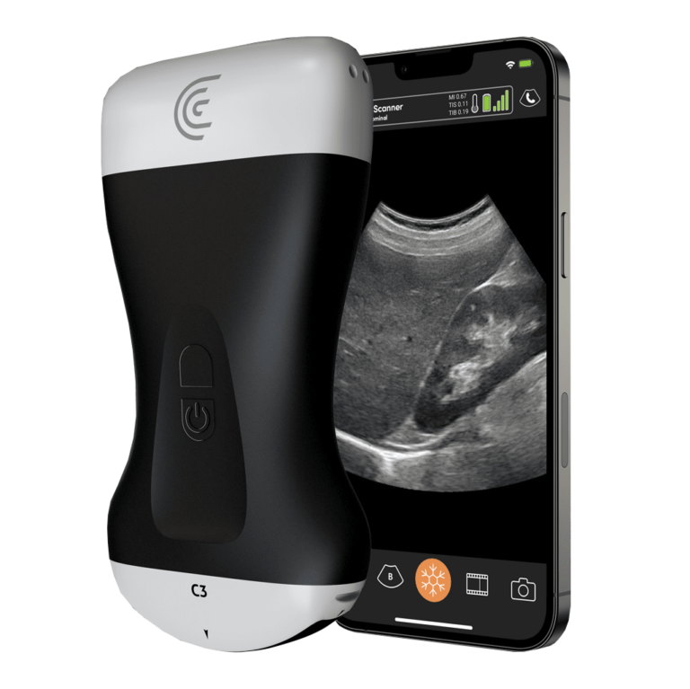 Portable & Wireless Ultrasound Scanner | DR.SONO®
