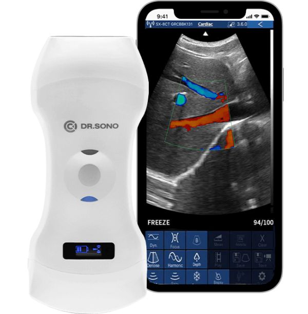 Portable Wireless Linear Probe Ultrasound Scanner | DR.SONO®