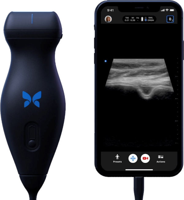 Portable & Wireless Ultrasound Scanner | DR.SONO®