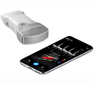How Much Does an Ultrasound Machine Cost: Buyer’s Guide + 12 Examples ...
