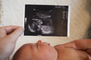 How to Read an Ultrasound: Text, Images, and Colors | DRSONO