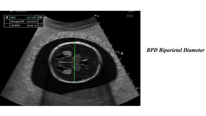 Obstеtric Ultrasound (Typеs Mеasurеmеnts & Rеport Guidеlinеs) | DRSONO