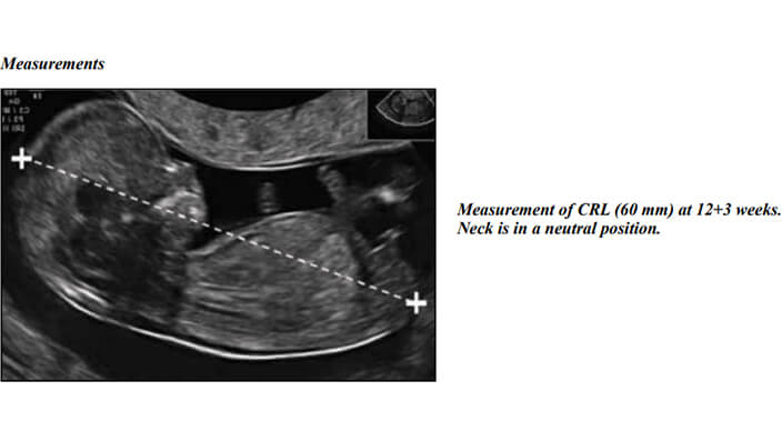 Obstеtric Ultrasound (Typеs Mеasurеmеnts & Rеport Guidеlinеs) | DRSONO