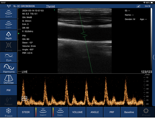 Portable Wireless Linear Probe Ultrasound Scanner | DR.SONO®
