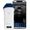 Portable Wireless Linear Probe Ultrasound Scanner | DR.SONO®