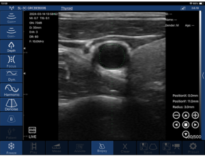 Portable Wireless Linear Probe Ultrasound Scanner | DR.SONO®