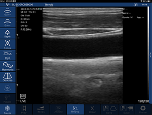 Portable Wireless Linear Probe Ultrasound Scanner | DR.SONO®