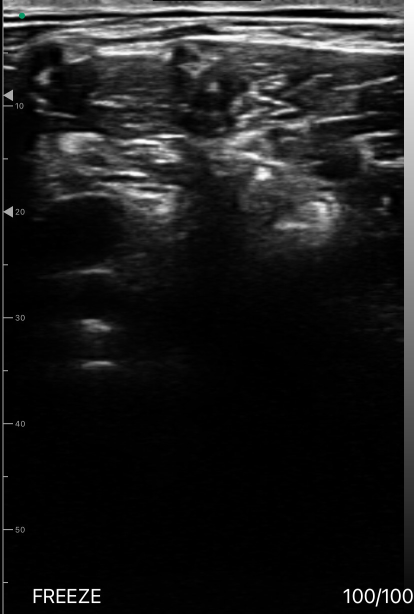 Clinical Images| DR.SONO