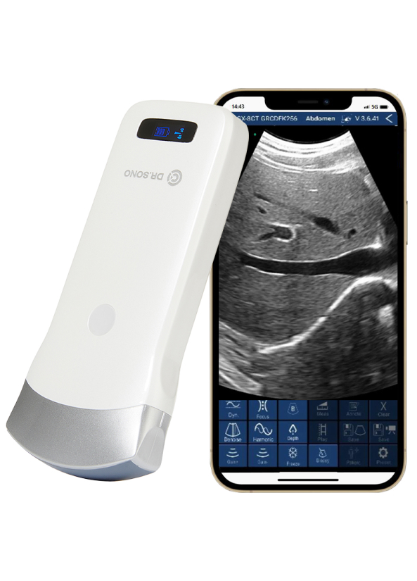 Portable & Handheld Convex Ultrasound Scanner | DR.SONO®