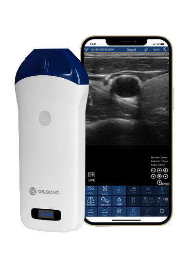 Portable Wireless Linear Probe Ultrasound Scanner | DR.SONO®