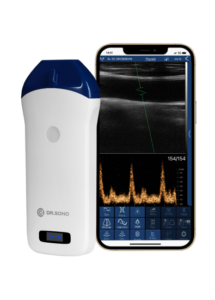Portable Wireless Linear Probe Ultrasound Scanner | DR.SONO®