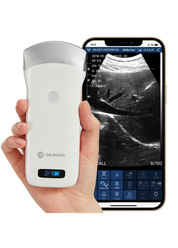 Portable & Handheld Convex Ultrasound Scanner | DR.SONO®