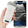 Best Portable Ultrasound Machine for Pregnancy in 2025