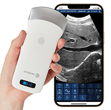 Best Portable Ultrasound Machine for Pregnancy in 2025