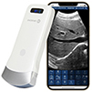 Best Portable Ultrasound Machine for Pregnancy in 2025