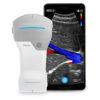 Best Portable Ultrasound Machine for Pregnancy in 2025