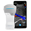 Best Portable Ultrasound Machine for Pregnancy in 2025