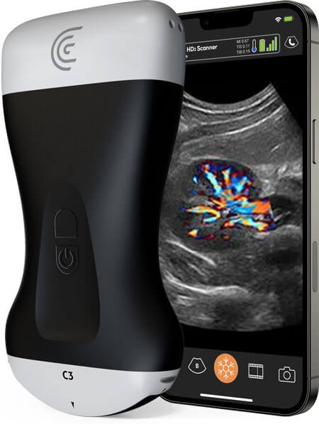 Top 6 iPhone and iPad Ultrasound Machines in 2025
