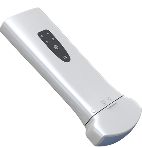 12 Affordable Portable & Handheld Ultrasound Machines