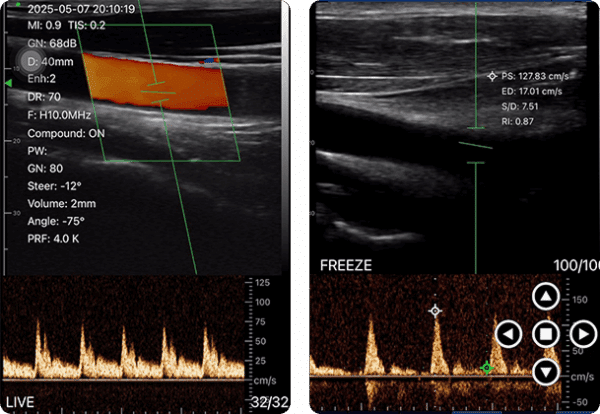 Top 5 Clinical Ultrasound Machines for 2026 (Prices, Features & More)