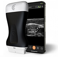 Best 9 IV Ultrasound Machines in 2025 (See Prices)
