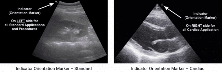 The Ultimate Guide to Ultrasound Probes (2026)