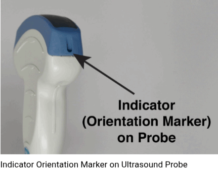 The Ultimate Guide to Ultrasound Probes (2025)