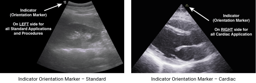 The Ultimate Guide to Ultrasound Probes (2025)