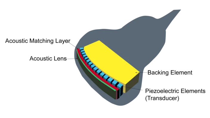 The Ultimate Guide to Ultrasound Probes (2025)