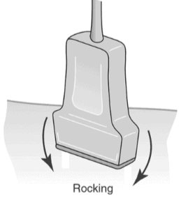 The Ultimate Guide to Ultrasound Probes (2025)