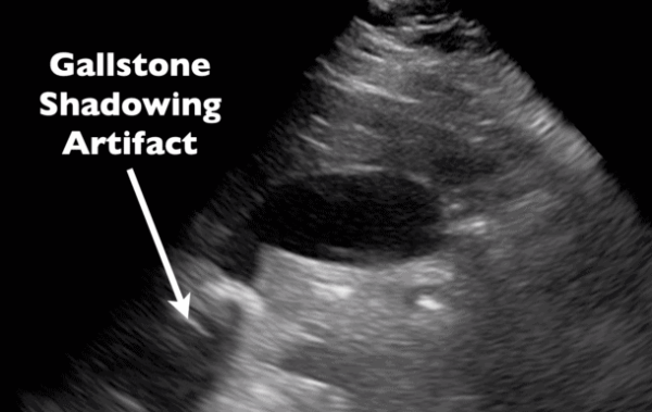The Ultimate Guide to Ultrasound Probes (2026)