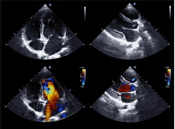 How to Read an Ultrasound: A Complete A-Z Guide | DRSONO