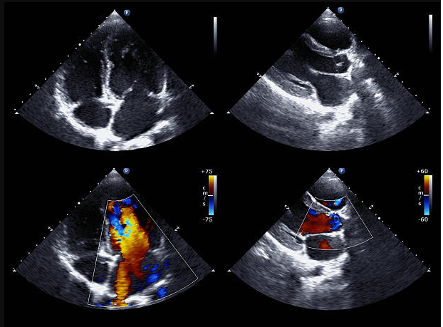 How to Read an Ultrasound: A Complete A-Z Guide | DRSONO