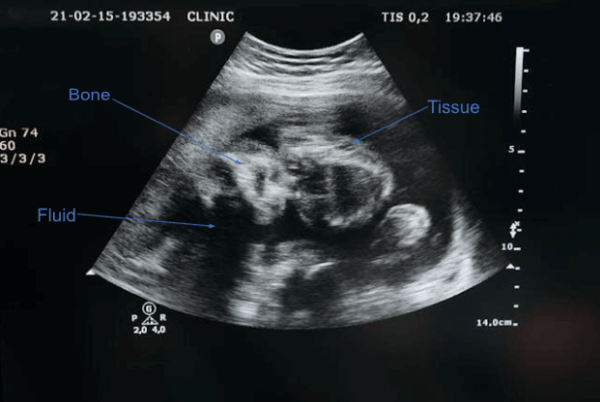 How to Read an Ultrasound: A Complete A-Z Guide | DRSONO
