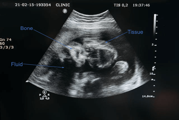How to Read an Ultrasound: A Complete A-Z Guide | DRSONO