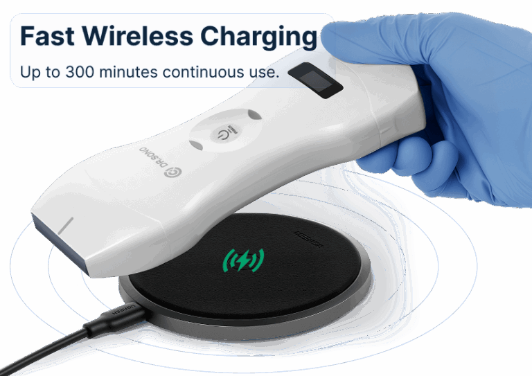 Portable & Wireless Ultrasound Scanner | DR.SONO®