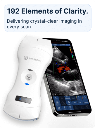 Portable & Wireless Ultrasound Scanner | DR.SONO®