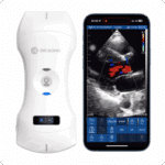 Best Portable Ultrasound Machine for Pregnancy in 2026