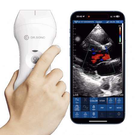 Best Portable Ultrasound Machine for Pregnancy in 2026