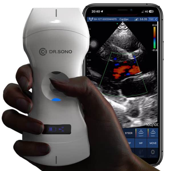 12 Affordable Portable & Handheld Ultrasound Machines
