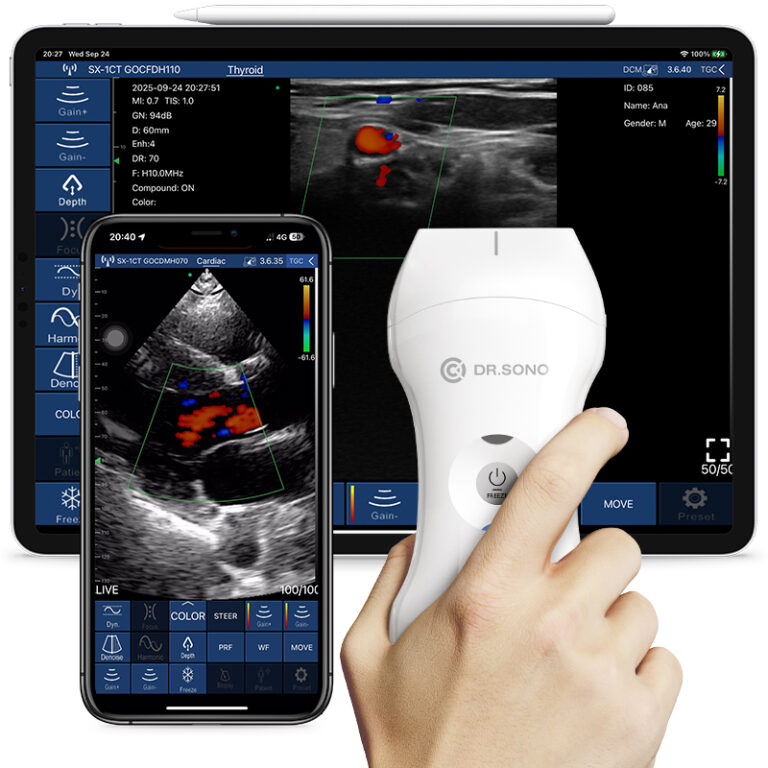 Vscan Air vs Clarius vs Butterfly IQ vs DRSONO: Which Is the Best ...