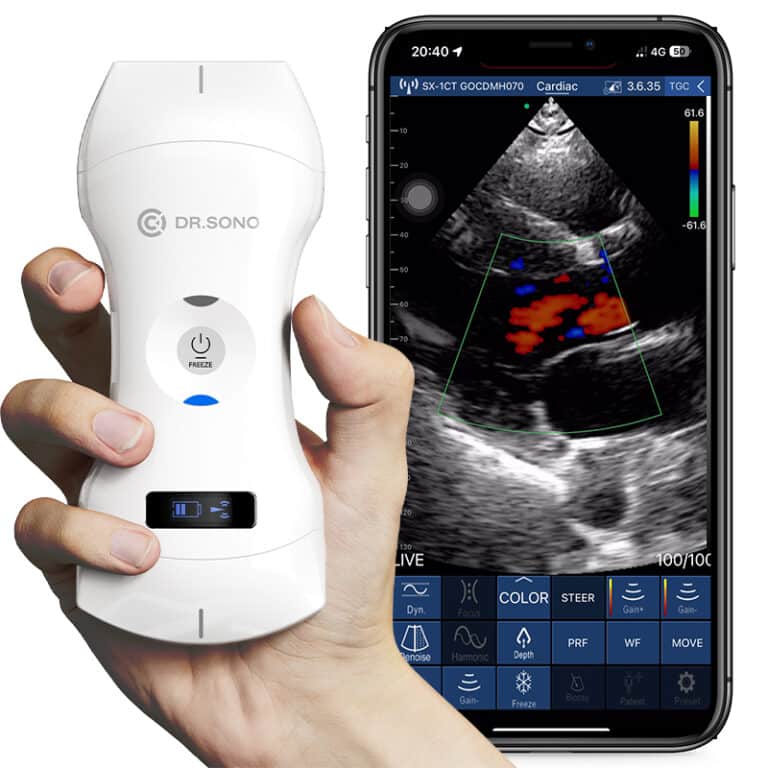 Top 6 iPhone and iPad Ultrasound Machines in 2026
